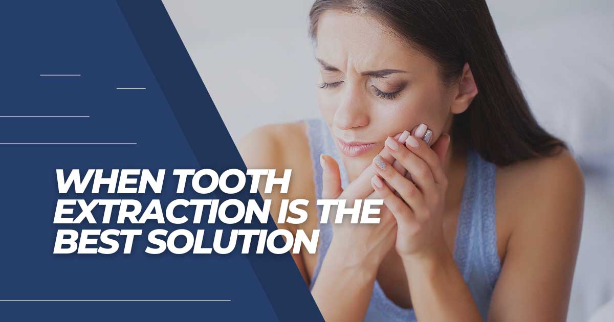 When Tooth Extraction Is The Best Solution - Kalamazoo Extractions